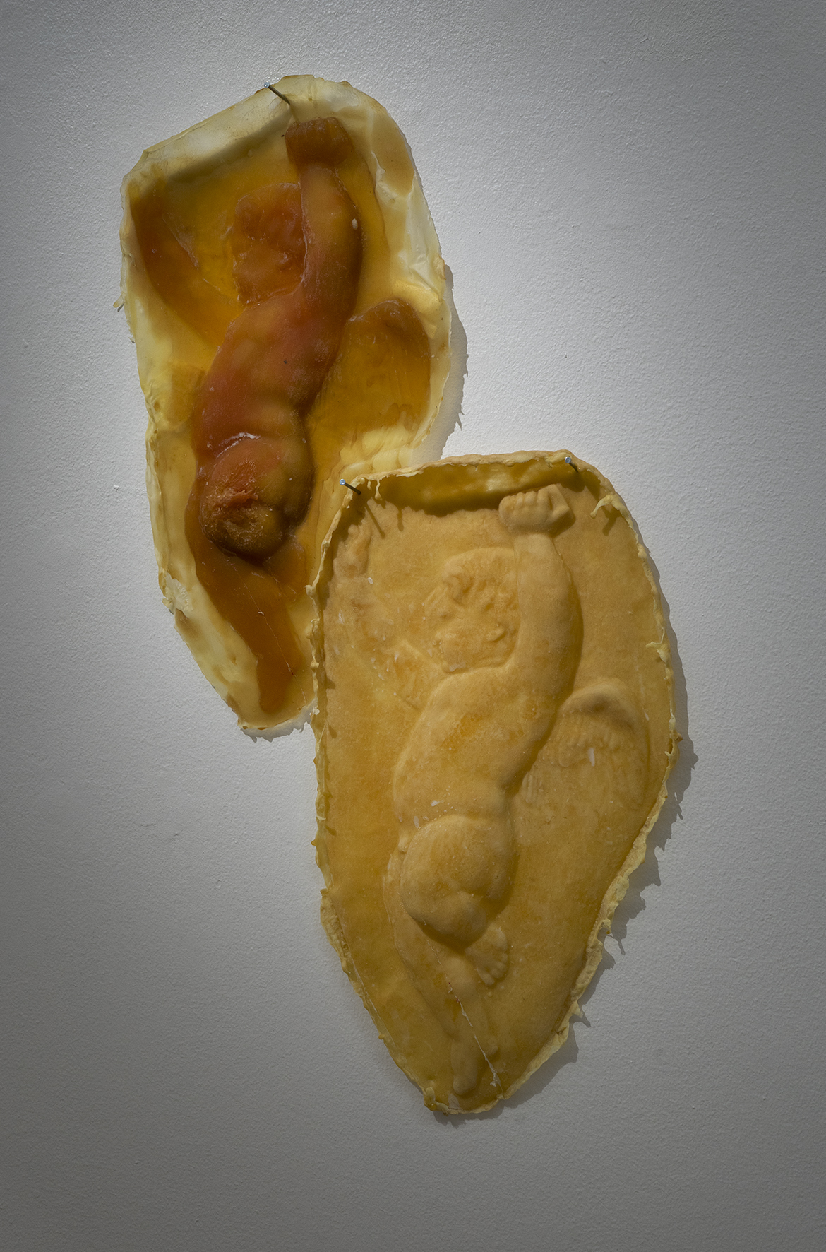 Diaries of a Bruised Princess